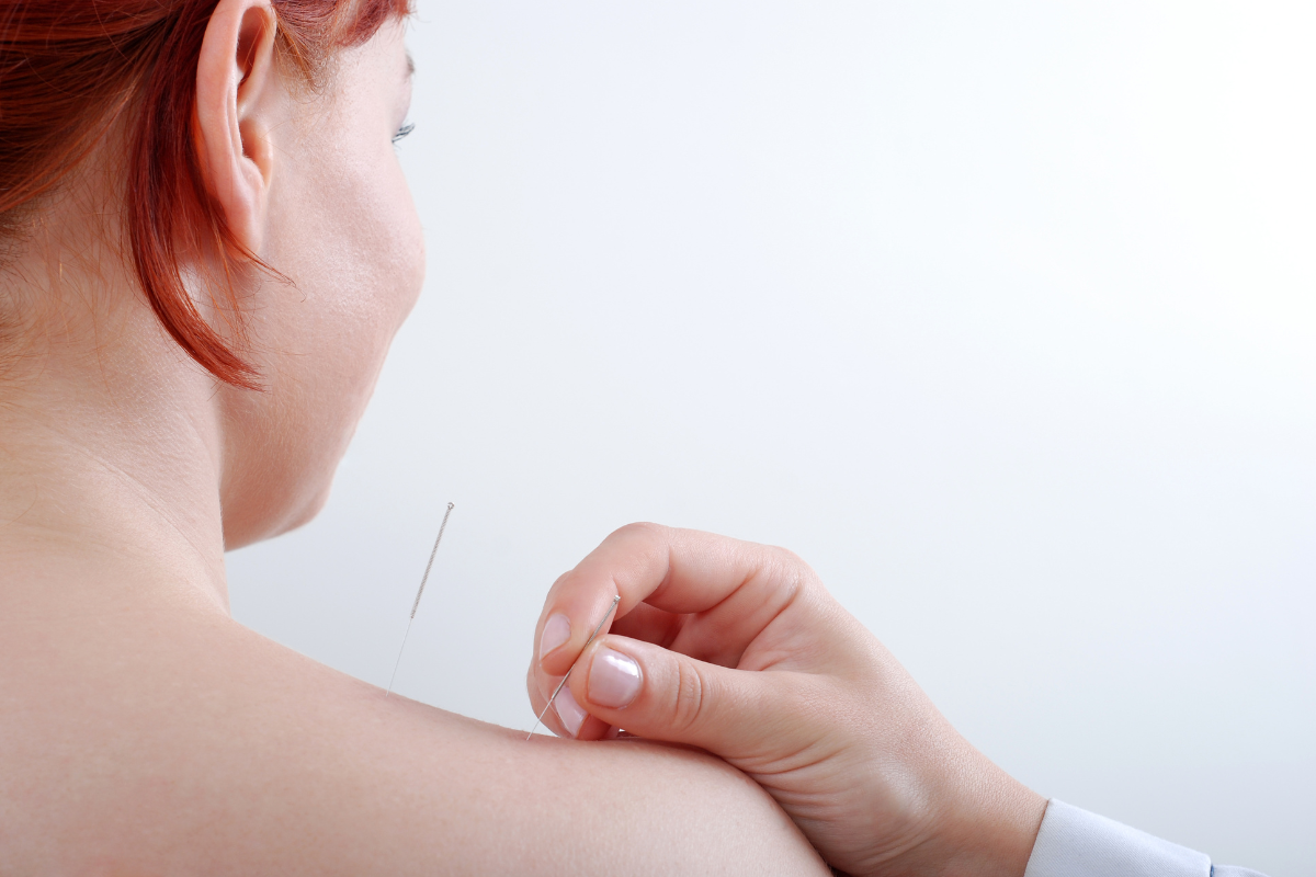 Acupuncture Pain Explained: Does It Really Hurt?