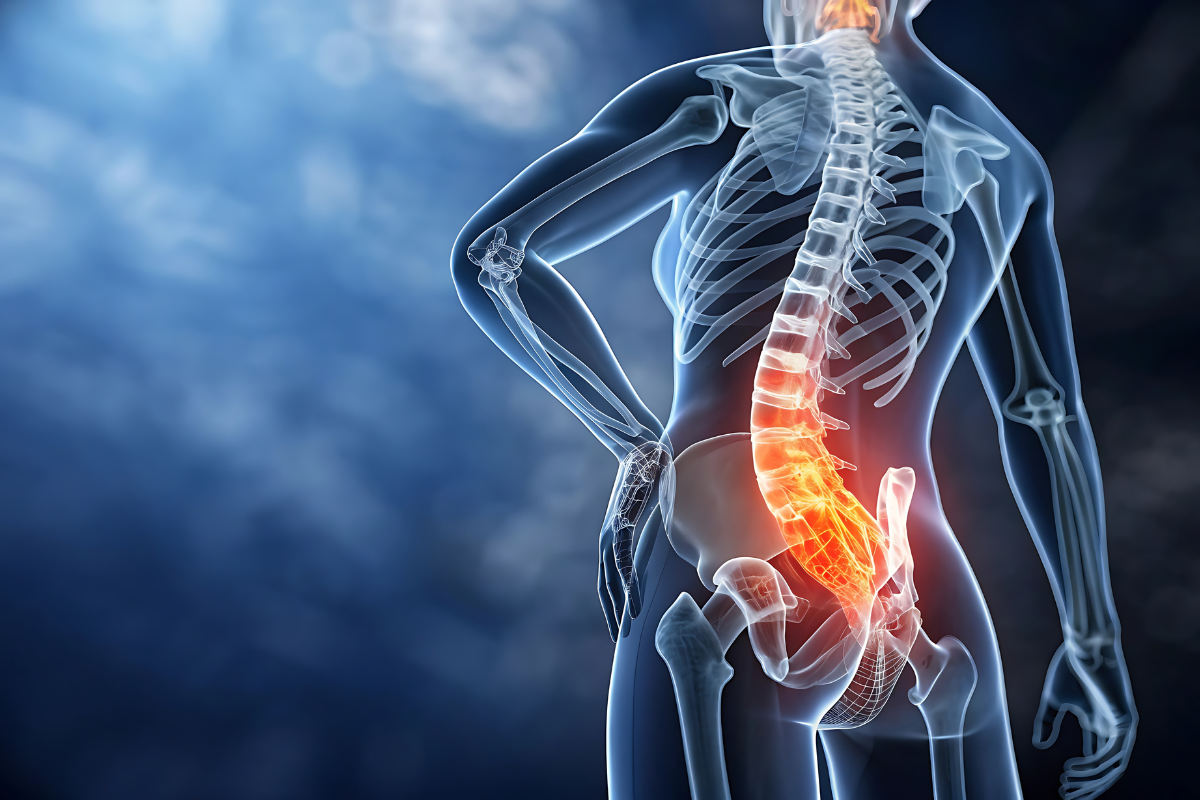 Trigger Point Injections for Piriformis Syndrome Relief