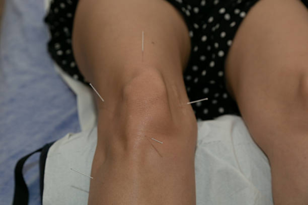 Top Steroids for Trigger Point Injections Explained